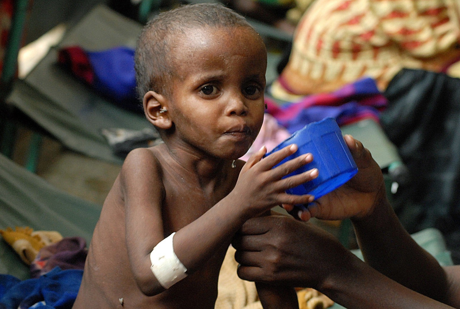 Malnutrition Global Pandemic Affects One Third Of World s Population Malnutrition Global Pandemic Affects One Third Of World s Population